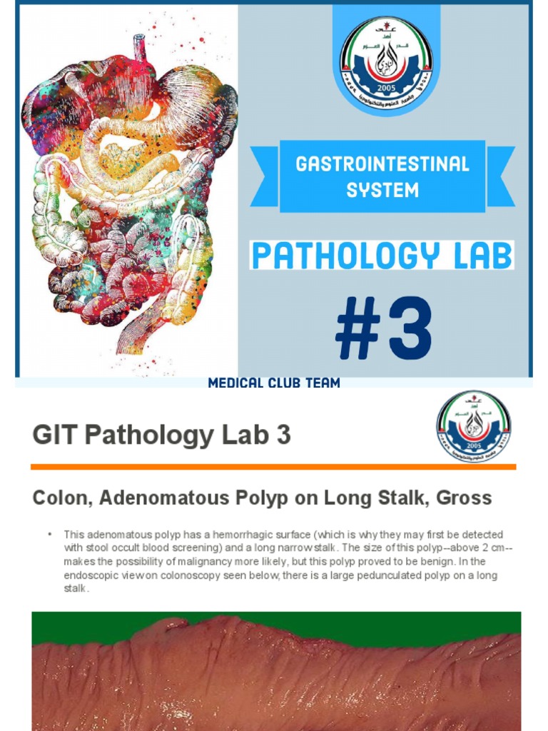 An Overview of Colon Pathology with a Focus on Polyp, Cancer, and ...