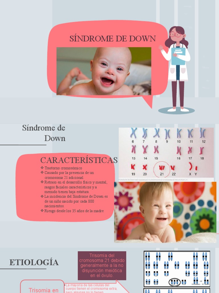 Sindrome de Down | PDF | Síndrome de Down | Ciencias de la Salud