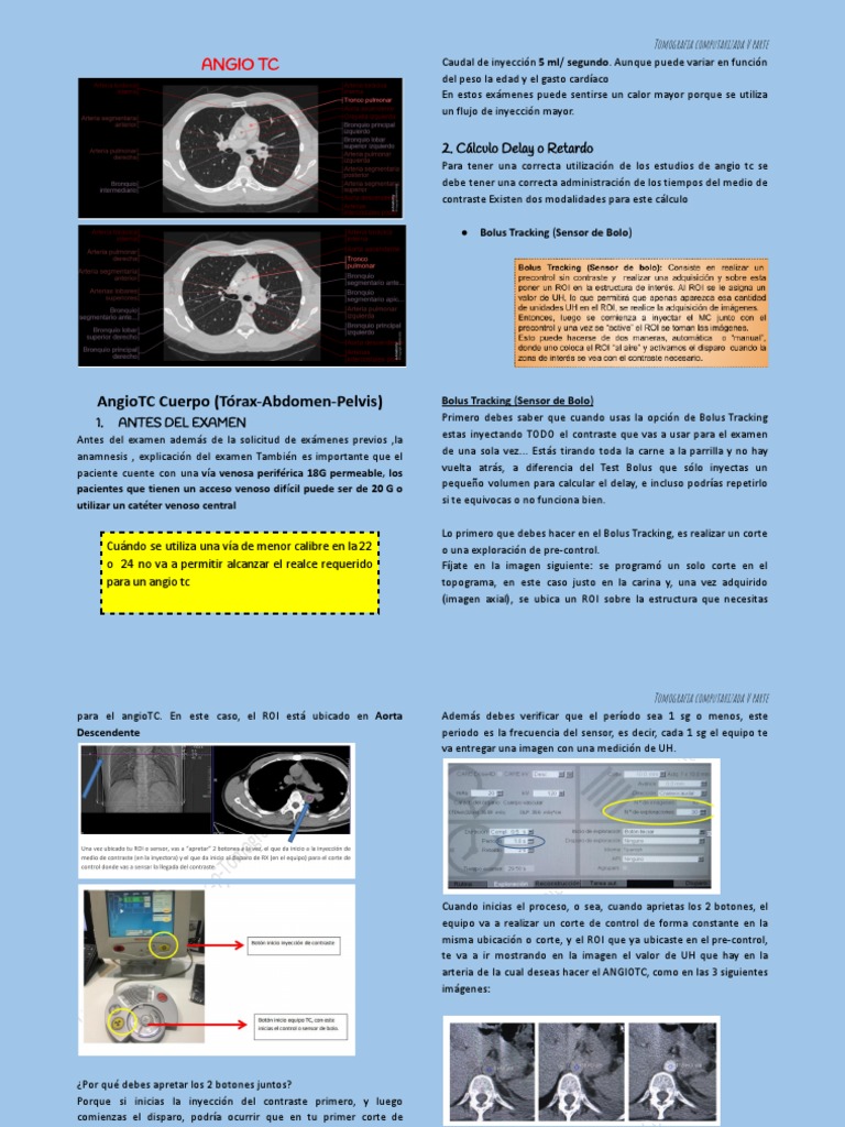 Angio TC | PDF | Aorta | Ct Scan