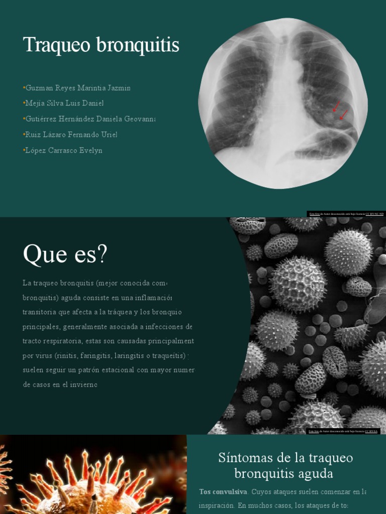 Traqueo Bronquitis: Síntomas y Tratamientos | PDF | Tos | Bronquitis