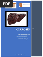 Escala Child-Pugh para Cirrosis Hepática | PDF