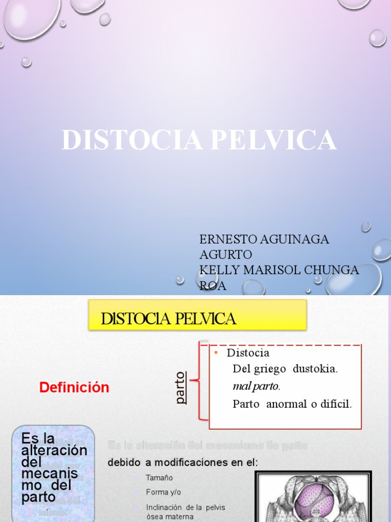 Distocias Pelvicas | PDF | Pelvis | Parto