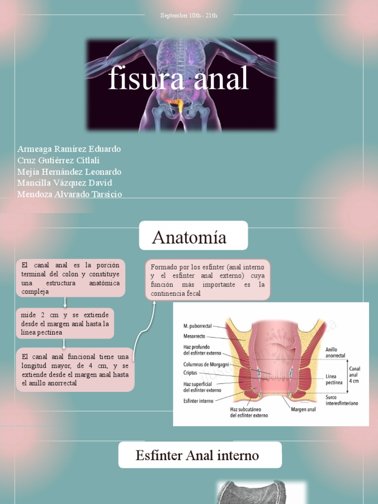 Fisura Anal Gastrocirugia FINAL | PDF | Hemorroides | Medicina CLINICA