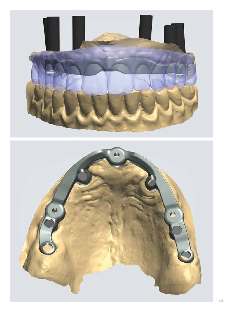 Protesis Total | PDF | Dentadura postiza | Ciencias fisicas