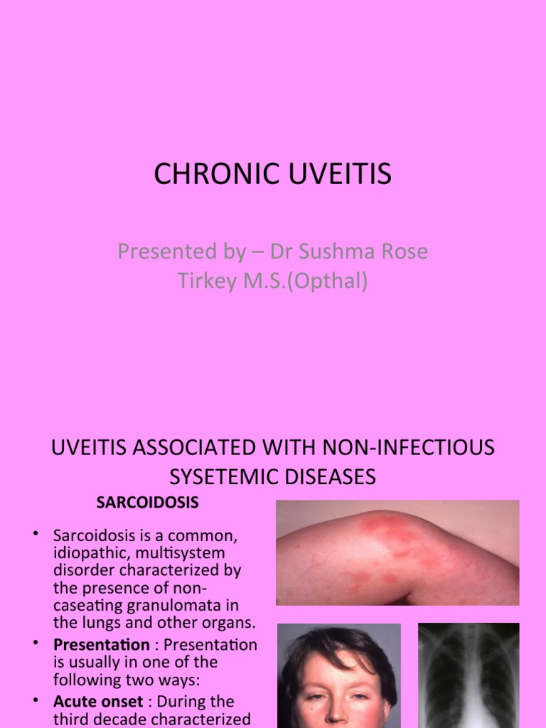 Chronic Uveitis and Associated Conditions | PDF | Medical Specialties ...