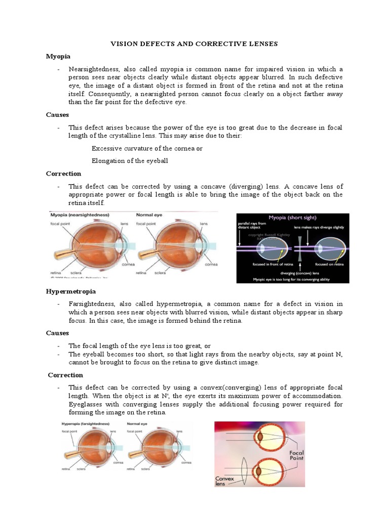 Eye Defects | PDF