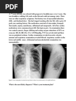 1307 Chest Tube Placement Procedure Note | PDF | Medical Procedures ...