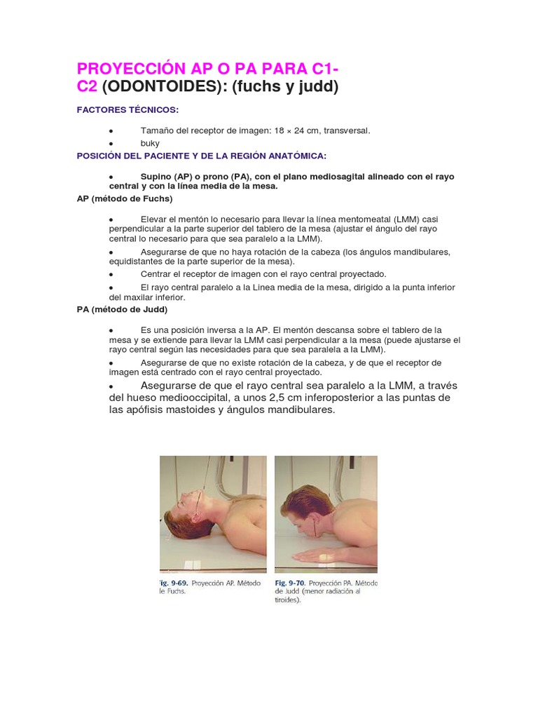 Proyecciones craneales AP y PA para la región C1-C2 (odontoides ...