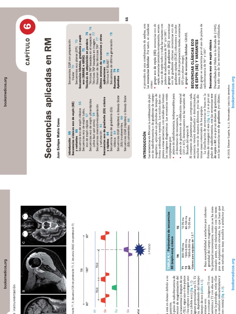 Secuencias en RM | PDF