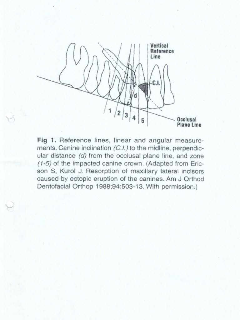 Ericson, Kurol - Reference lines example | PDF