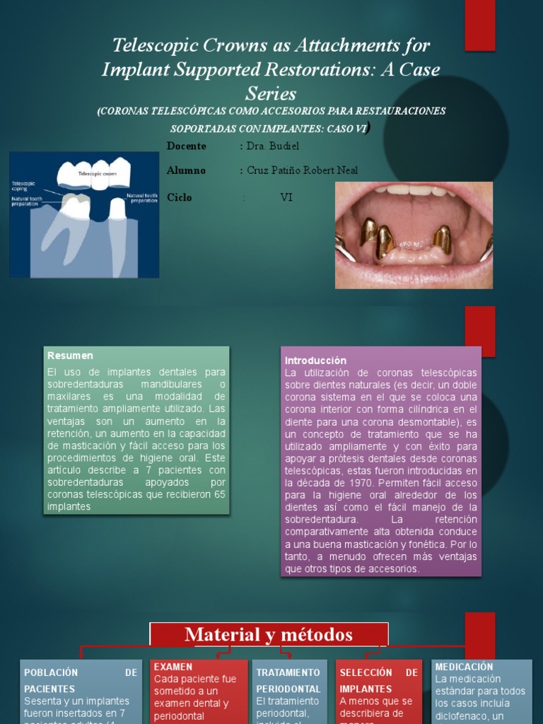 Coronas Telescopicas | PDF | Dentadura postiza | Especialidades Medicas