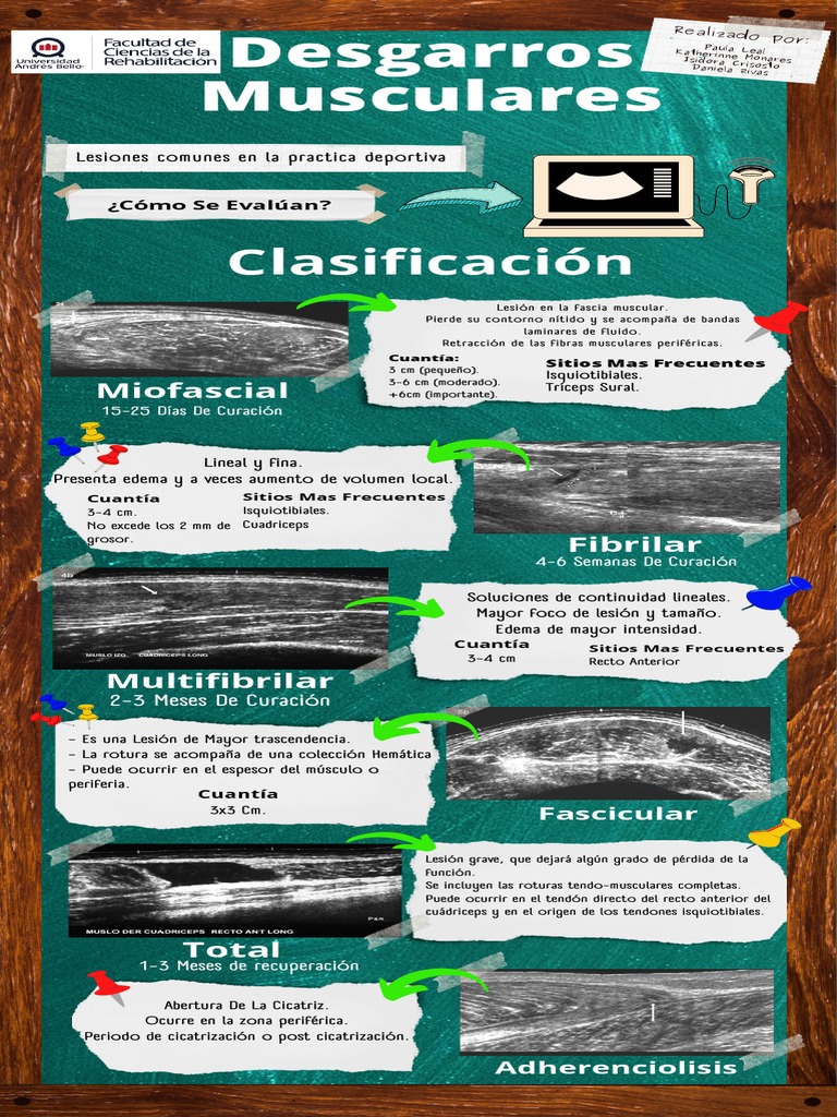 Clasificación: Desgarros Musculares | PDF | Músculo | Anatomía humana