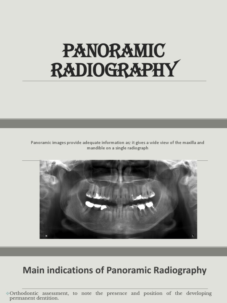 Panoramic Radiography | PDF | Radiography | X Ray