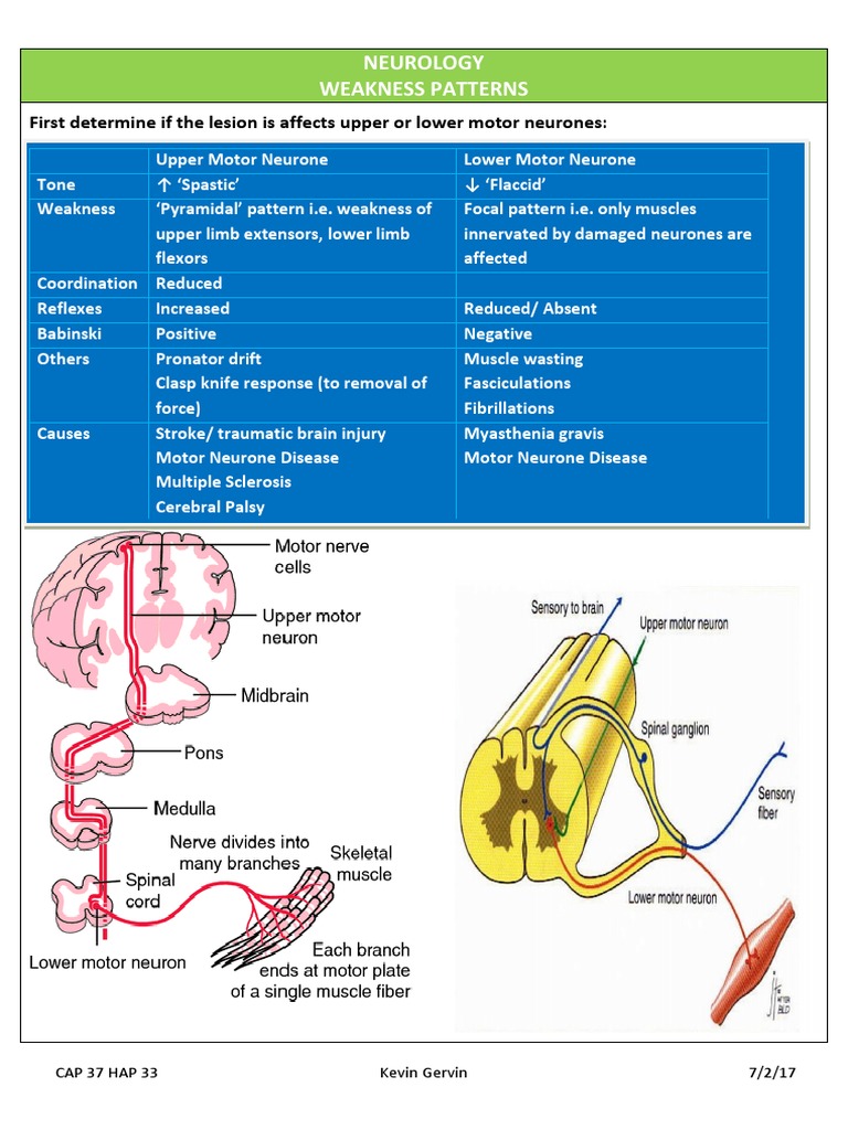 Neurology Weakness Patterns Explained | PDF | Neurological Disorders ...