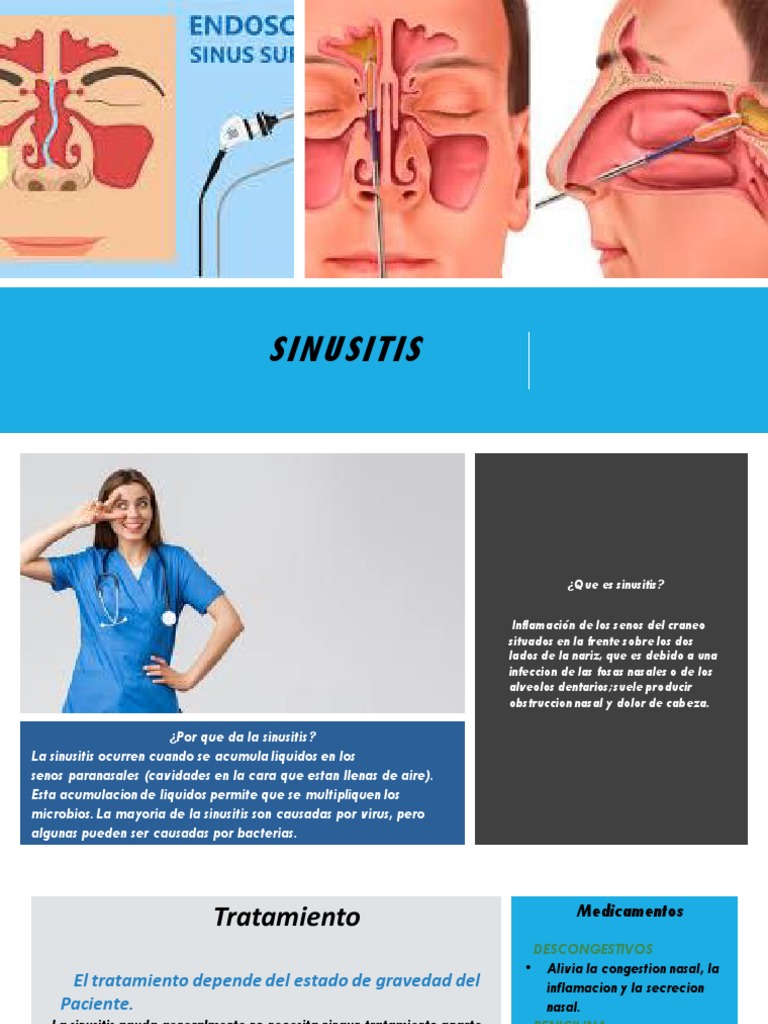 Sinusitis | PDF | Enfermedades y trastornos | Medicina