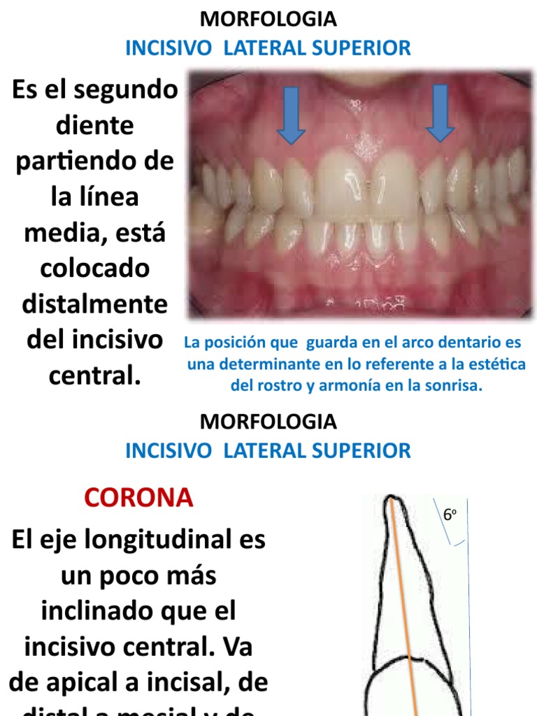 Es El Segundo Diente Partiendo de La Línea Media, Está Colocado ...