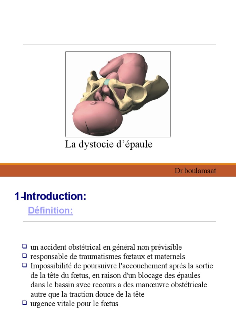 La Dystocie D'épaule: DR - Boulamaat | PDF