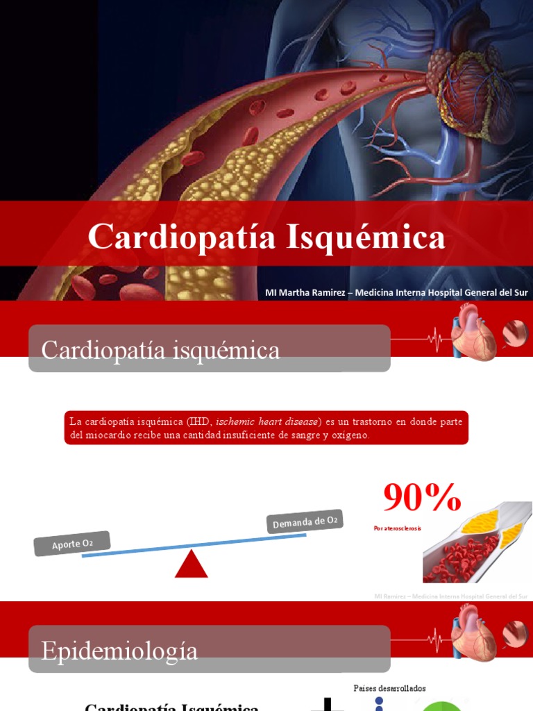 Cardiopatia Isquemica | PDF | Infarto de miocardio | Isquemia