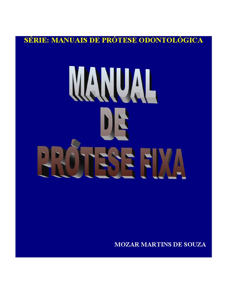 Prótese Fixa: Manual com Técnicas de Moldagem, Vazamento de Modelos e ...