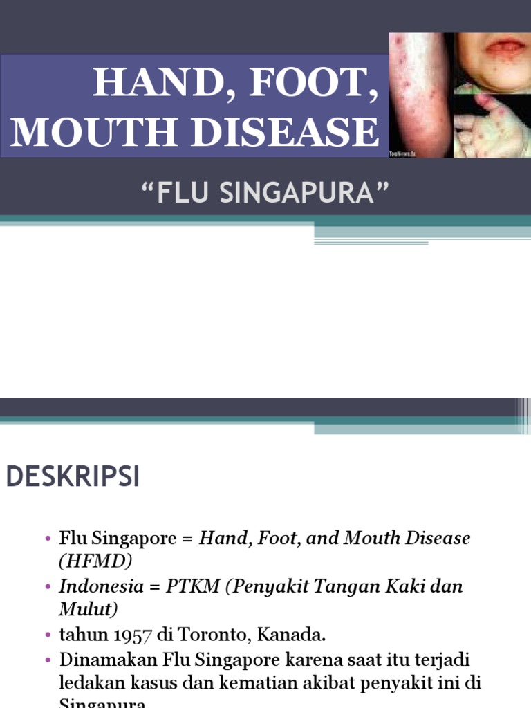 Penyakit Tangan Kaki dan Mulut (HFMD) | PDF