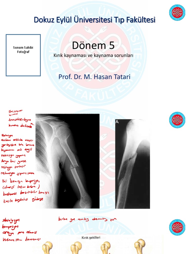 DR - Hasan TATARI-KIRIK KAYNAMASI VE KAYNAMA SORUNLARI | PDF