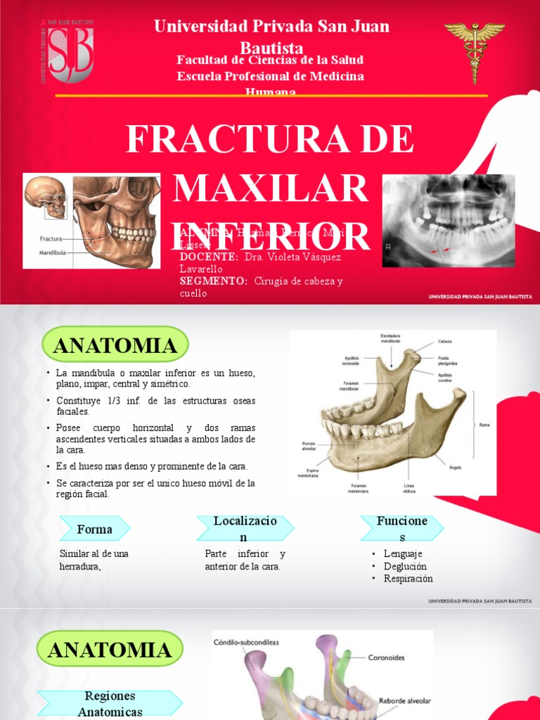 Fractura de Maxilar Inferior | PDF | Medicina CLINICA
