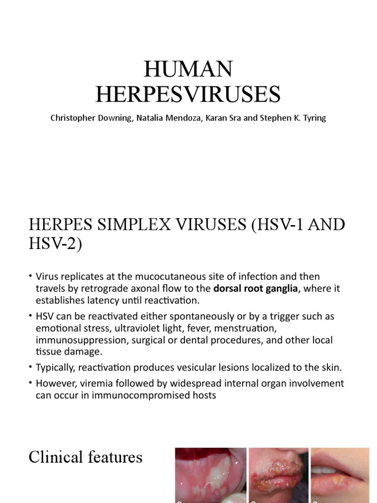 Human Herpesviruses: Christopher Downing, Natalia Mendoza, Karan Sra ...