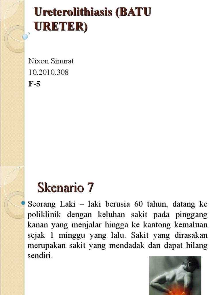 Ureterolithiasis 55d2955071d60 | PDF