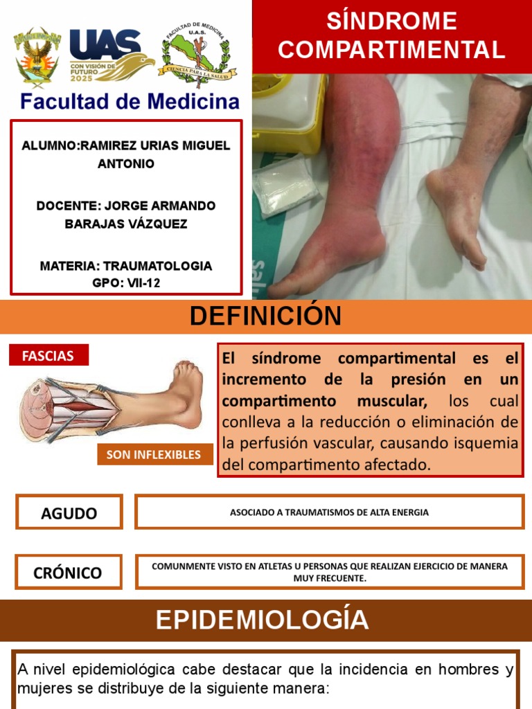 Sindrome Compartimental | PDF | Medicina CLINICA | Especialidades Medicas