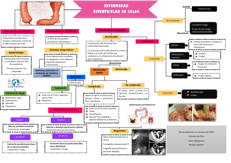 Enfermedad Diverticular De Colon PDF Gastroenterolog a