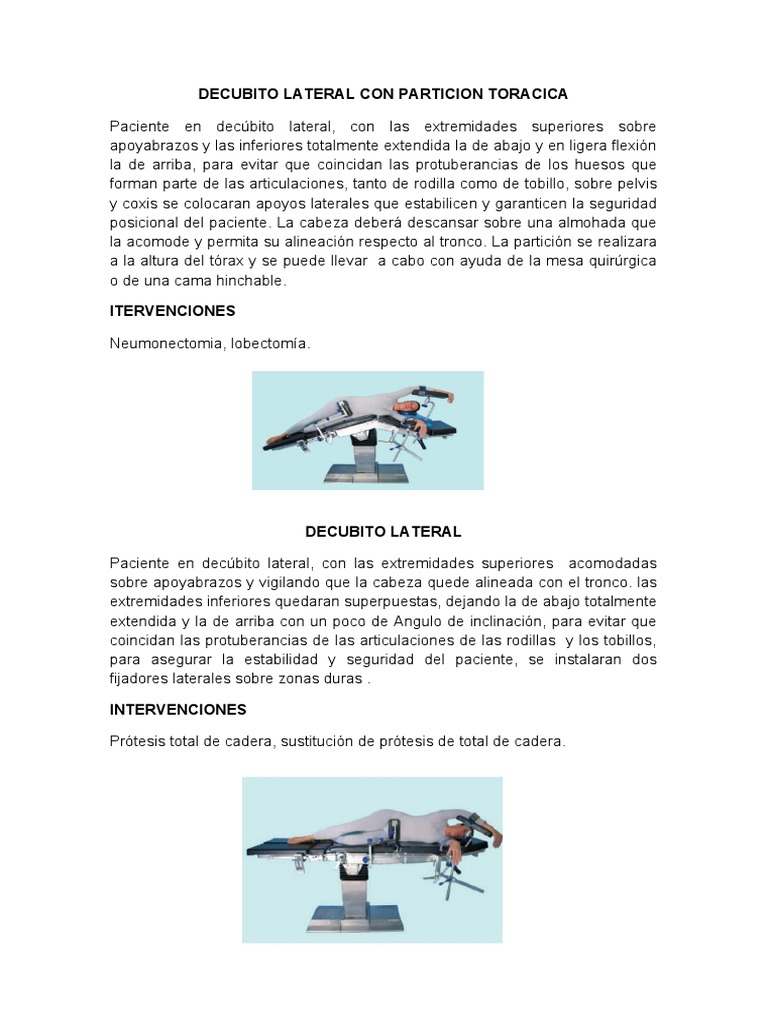 Decúbito Lateral con Partición Torácica | PDF