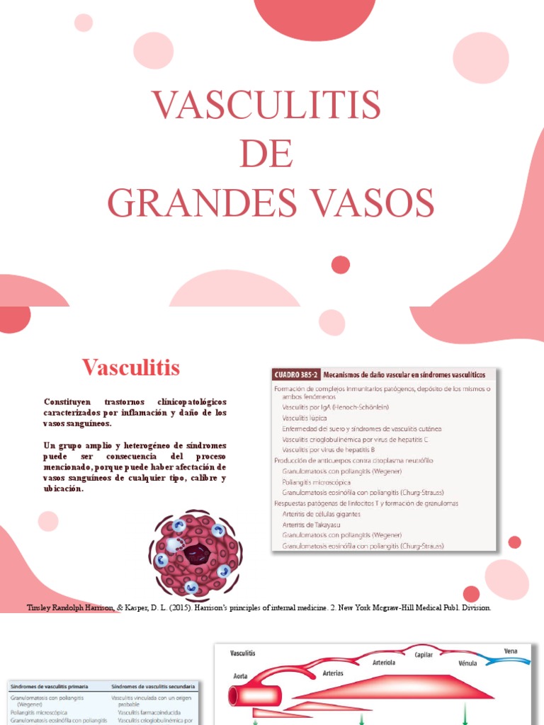 Vasculitis de Grandes Vasos | PDF | Hipertensión | Enfermedades y trastornos humanos