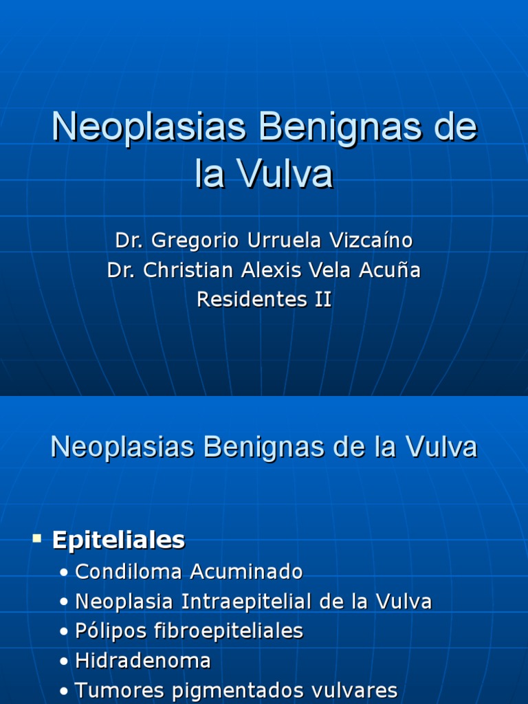 Neoplasias Benignas de La Vulva2 1234317299384269 1 | PDF | Neoplasias ...