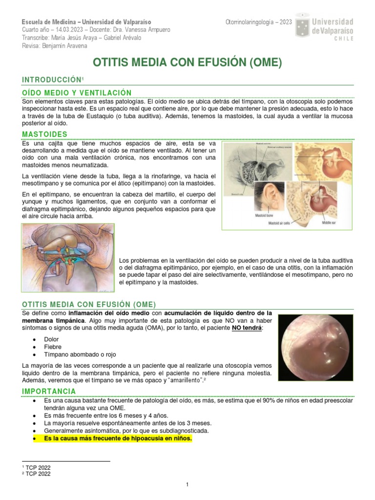 Otología II - Otitis Media Con Efusión (OME) (14-03) | PDF | Oído ...