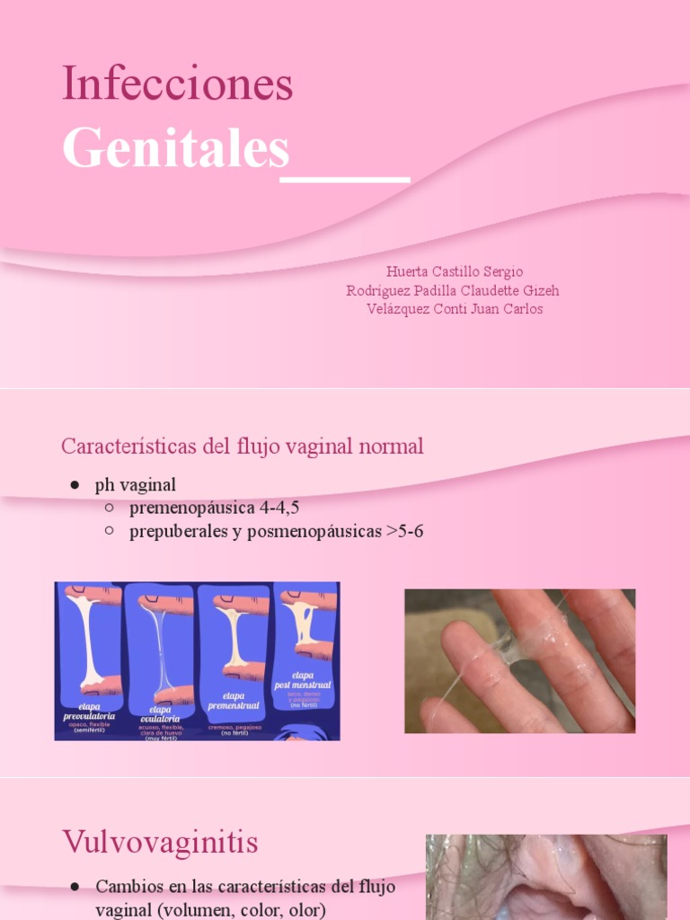 Infecciones Genitales y Vulvovaginitis | PDF | Candidiasis | Infección ...