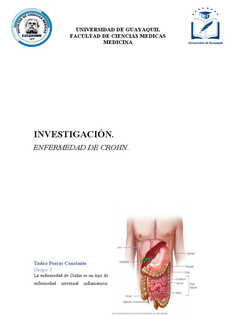 Enfermedad de Crohn | PDF | Enfermedad de Crohn | Ciencias de la Salud
