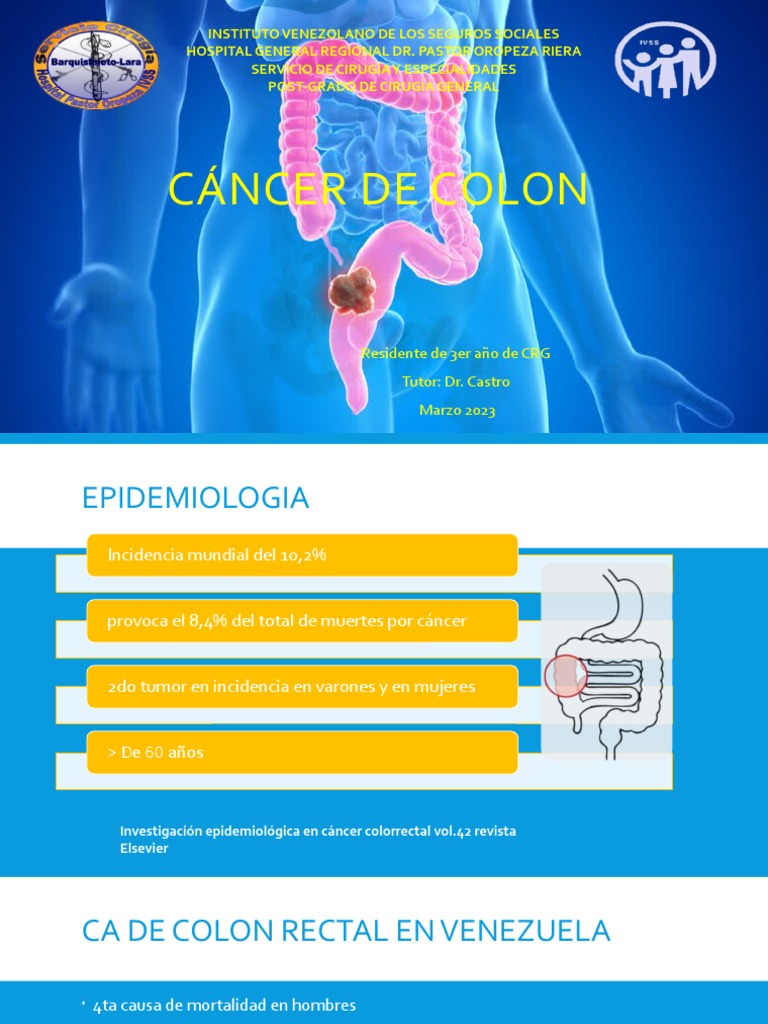 Cáncer De. Colon | PDF | Cáncer colonrectal | Cáncer