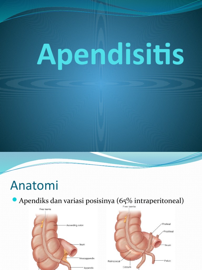 Apendisitix | PDF