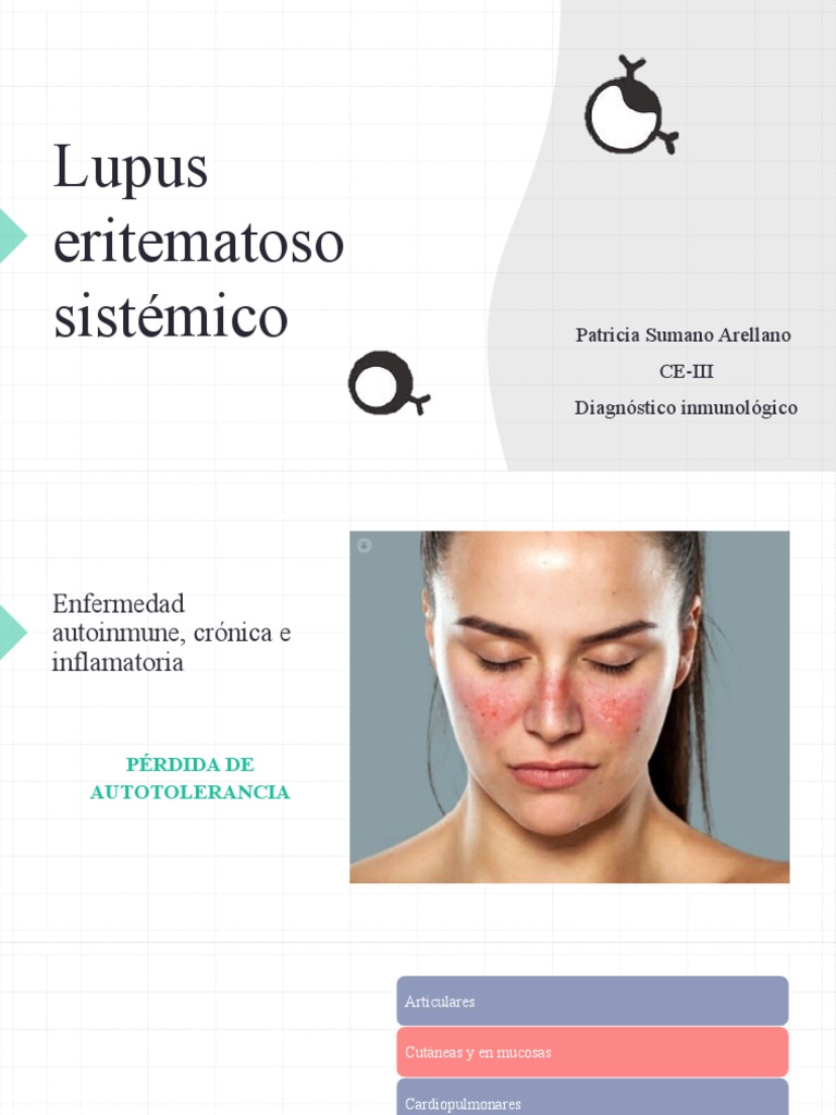 Lupus Eritematoso Sistemico | PDF | Medicina CLINICA | Ciencias de la Salud