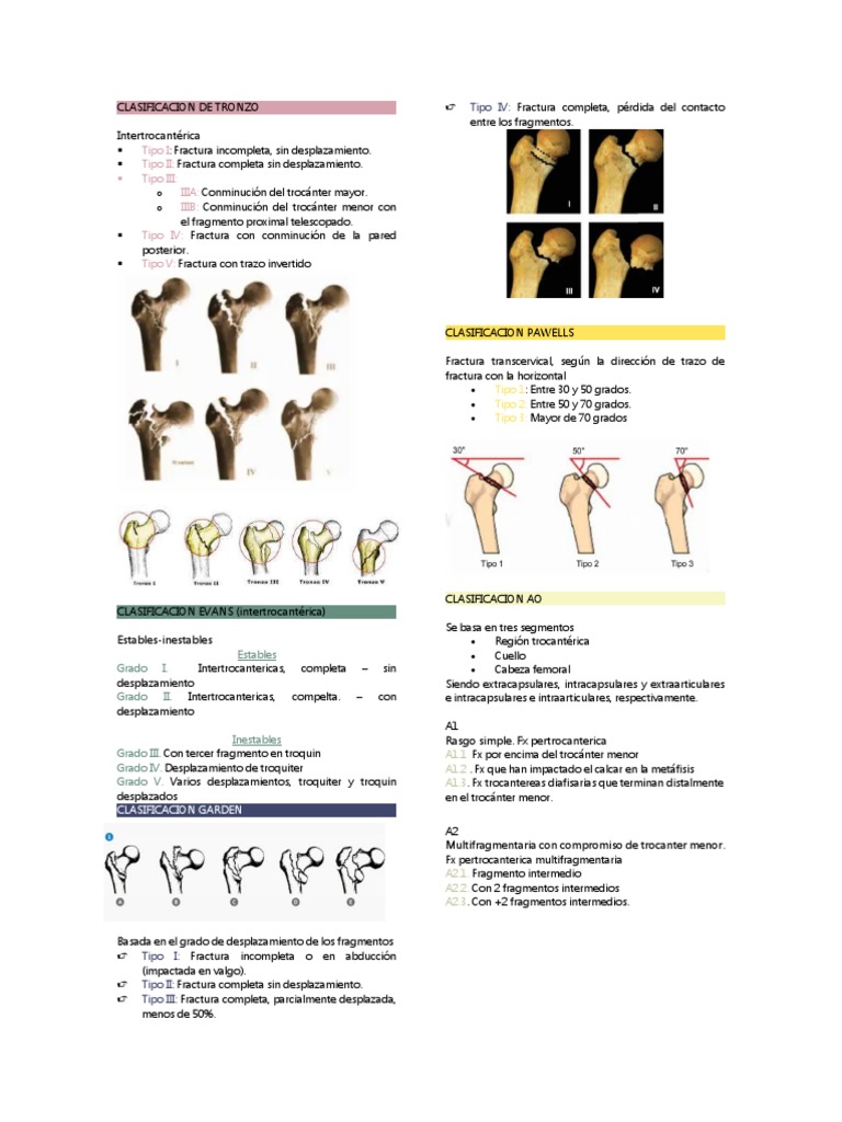 Clasificaciones FX Trauma | PDF | Sistema musculoesquelético