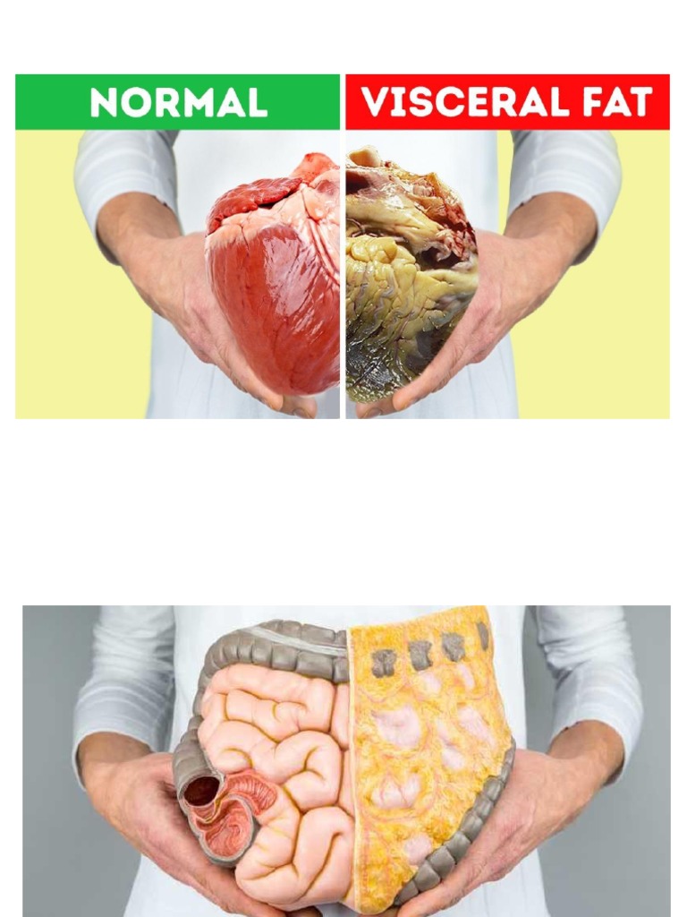 Viseral Fat | PDF