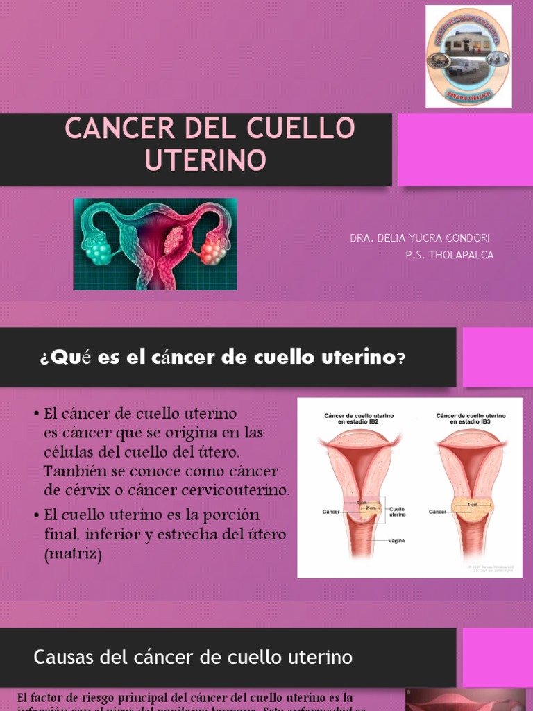 Cancer Del Cuello Uterino | Descargar gratis PDF | Cáncer de cuello uterino | Cáncer