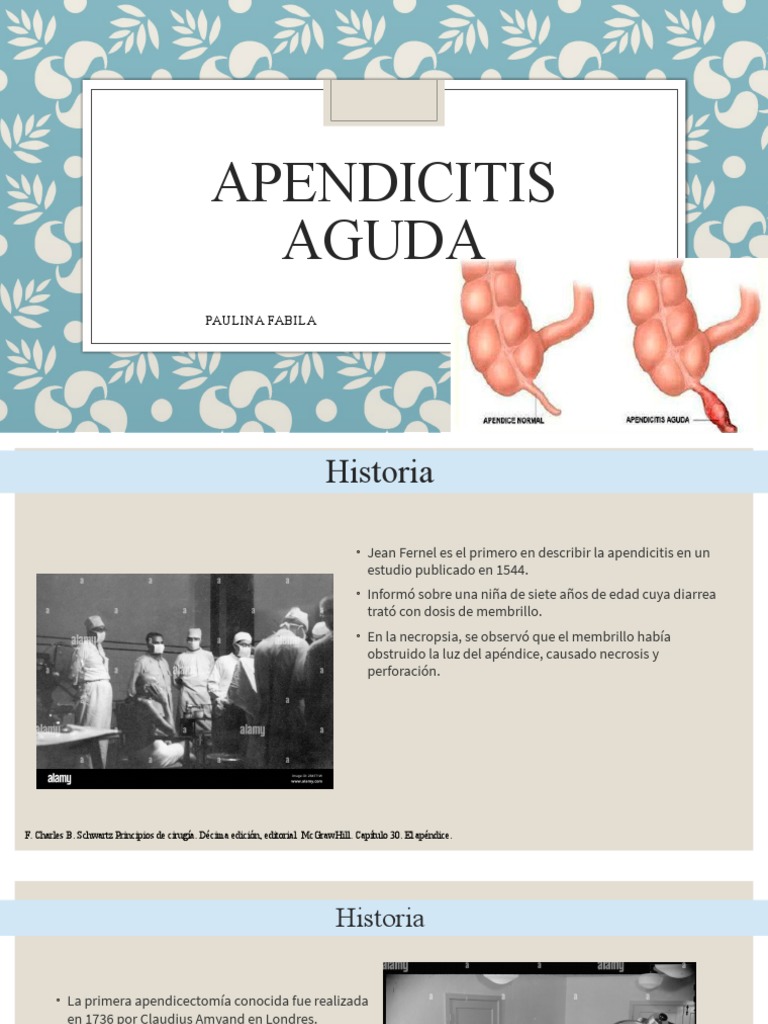 Apendicitis Aguda Pediatría | PDF | Especialidades Medicas | Medicina CLINICA