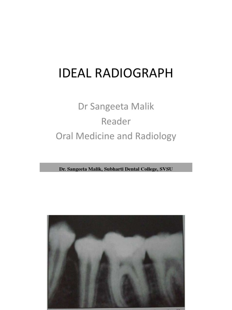 Ideal Radiograph: DR Sangeeta Malik Reader Oral Medicine and Radiology ...