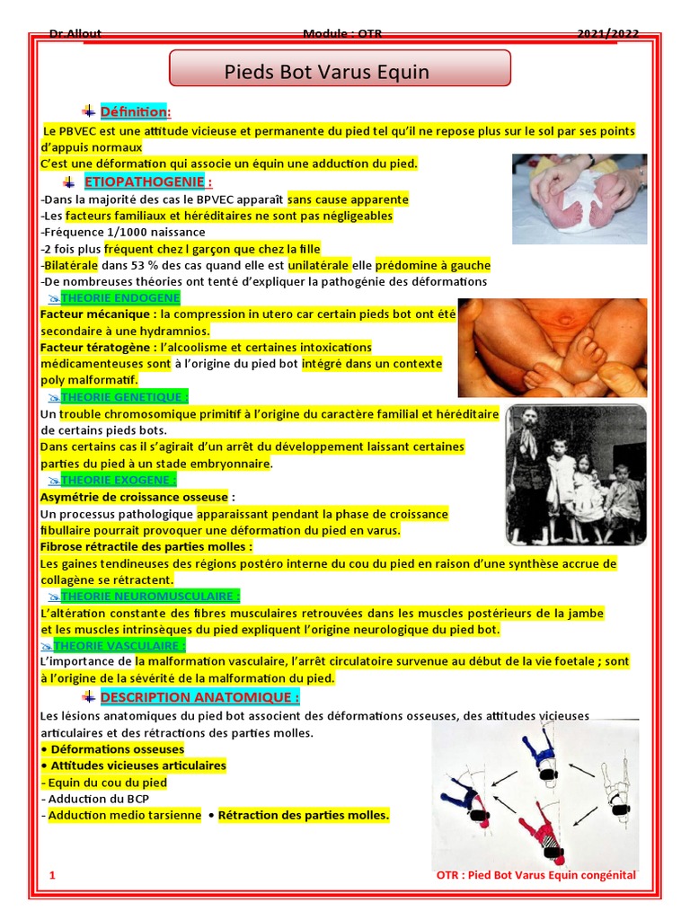 21-Pied-Bot-Varus-Equin-congénital Org | PDF