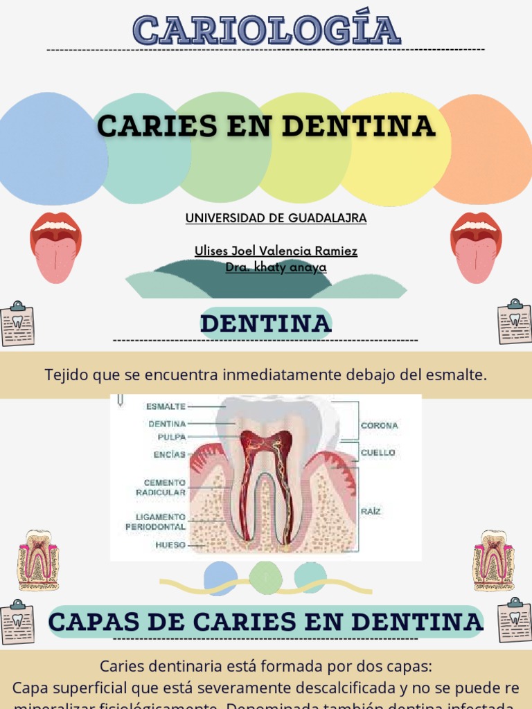 Cariología: Universidad de Guadalajra Ulises Joel Valencia Ramiez Dra ...