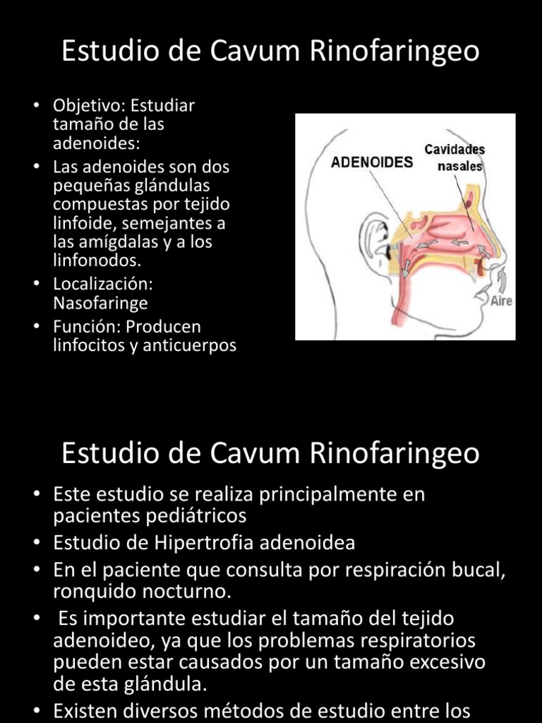 Estudio de Cavum Rinofaringeo | PDF | Cabeza y cuello humanos ...