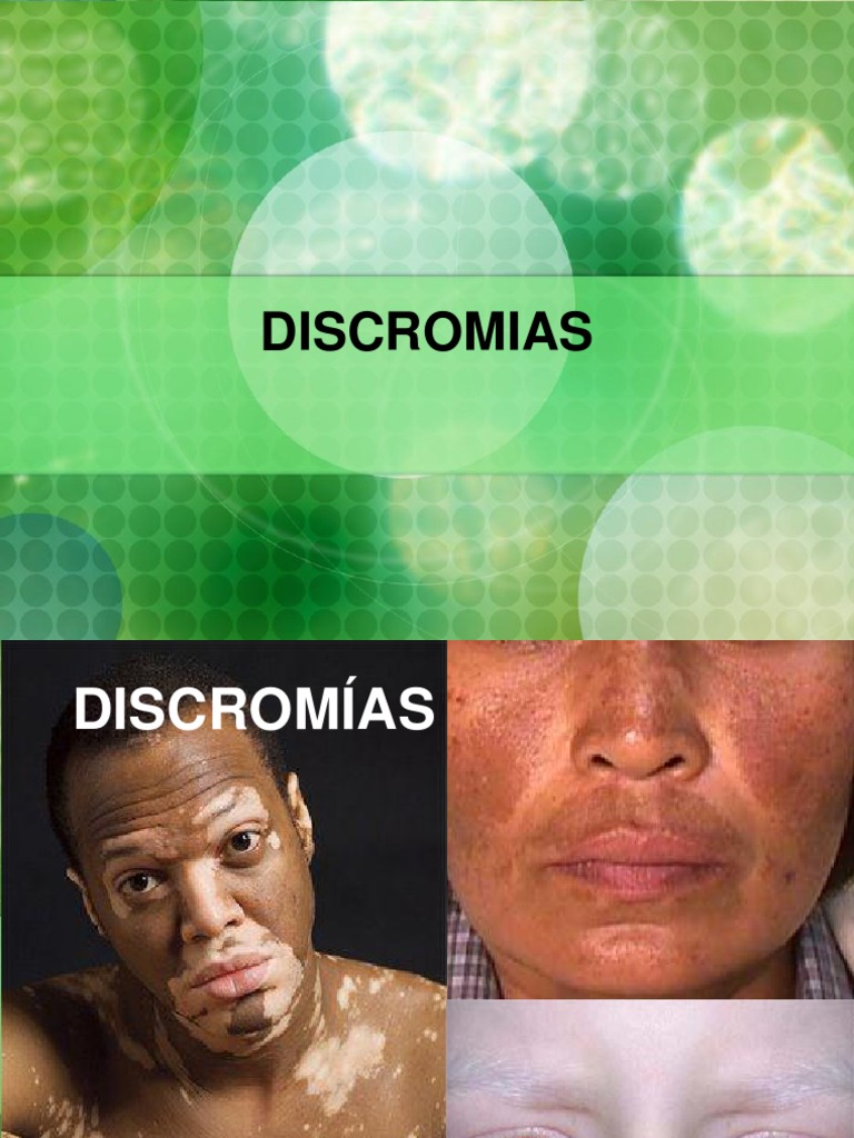 DISCROMIAS | PDF | Piel | Enfermedades y trastornos