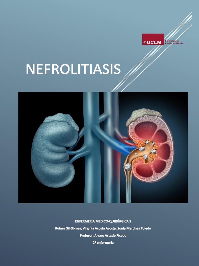 Nefrolitiasis FINAL | PDF | Vejiga urinaria | Medicina