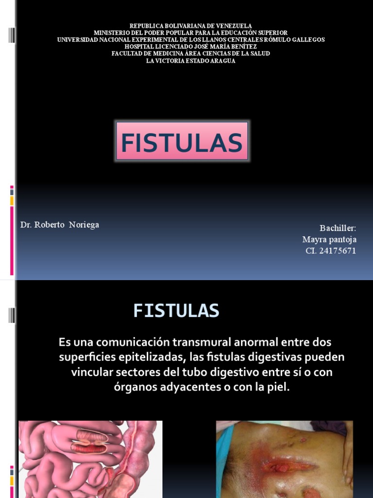 Clasificación y manejo de fístulas intestinales | PDF | Septicemia ...